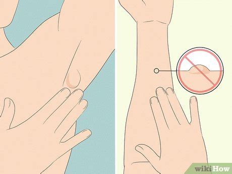 What Infections Cause Swollen Armpit Lymph Nodes Infoupdate Org