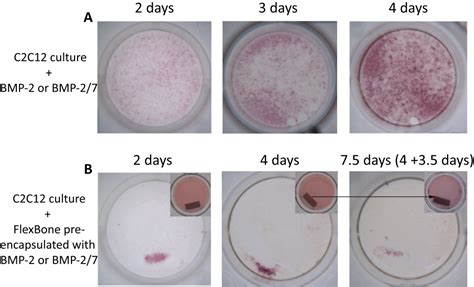 Scalable Functional Bone Substitutes Strategic Integration Of Key Structural Elements Of Bone
