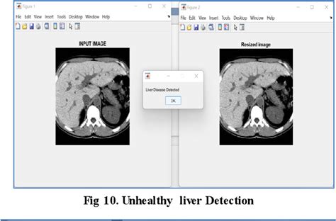 Figure 1 From Unhealthy Liver Detection Using Cnn With Iot Semantic