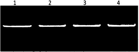 Method For Detecting Single Nucleotide Polymorphism Of Sex Determining