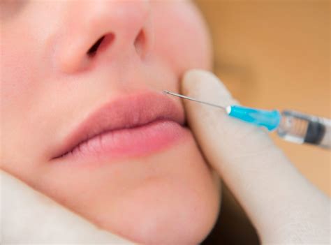 Easiest Way To Get Huge Big Lips Without Surgery Lip Plumper Remedy