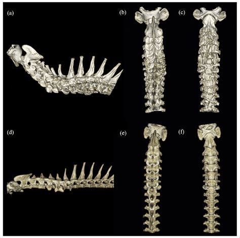A C Ct Three Dimensional Volume Rendering Reconstruction Of The Download Scientific Diagram