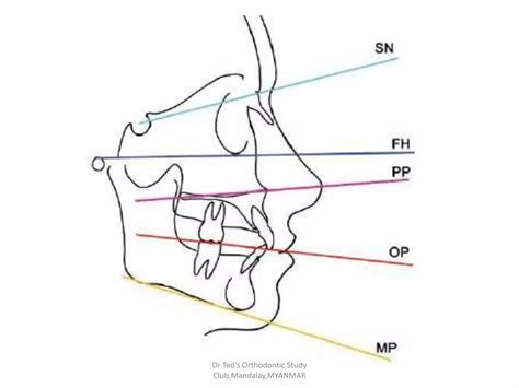 Practical Cephalometric Tracing Pptx Dental Health Diseases And