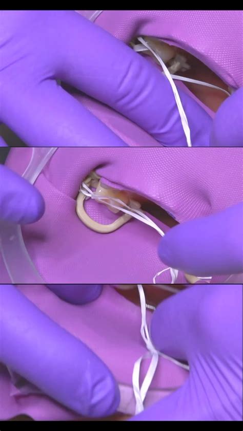 The Best Of Prosth Added A New Photo The Best Of Prosth