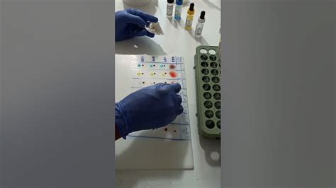 Le Groupe Sanguin Épreuve Globulaire Et Épreuve Sérique Youtube