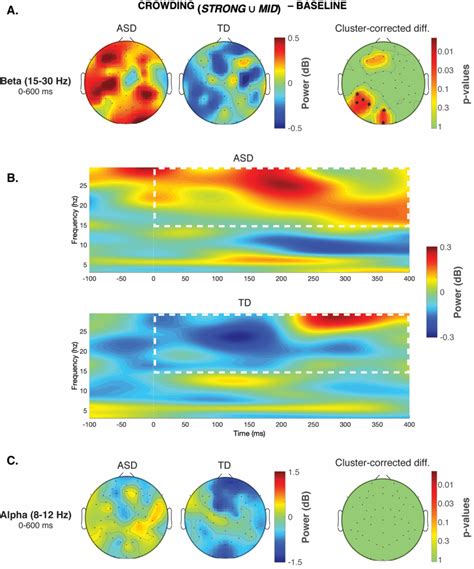 Event Related Oscillatory Activity Reflecting Detailed Oriented