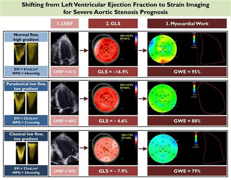 Shifting From Left Ventricular Ejection Fraction Lvef To Strain