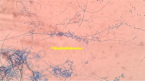 Dermatophyte Test Medium Dtm Introduction Composition
