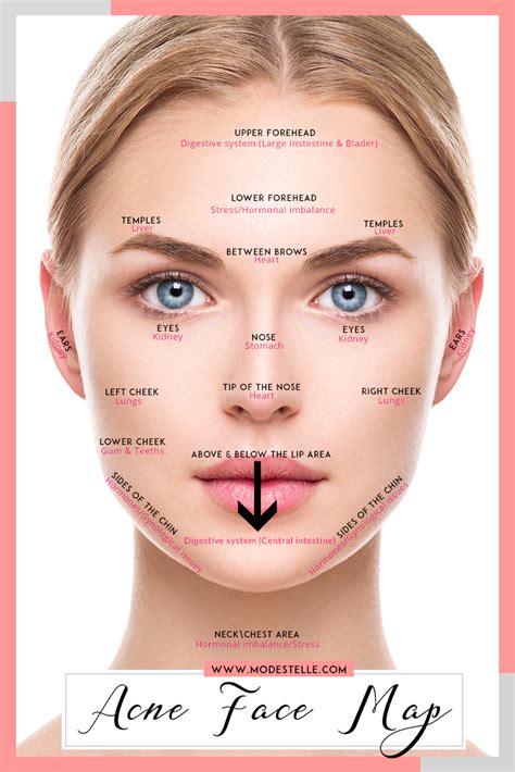 Face Mapping Acne Under Nose At Ruth Sapp Blog