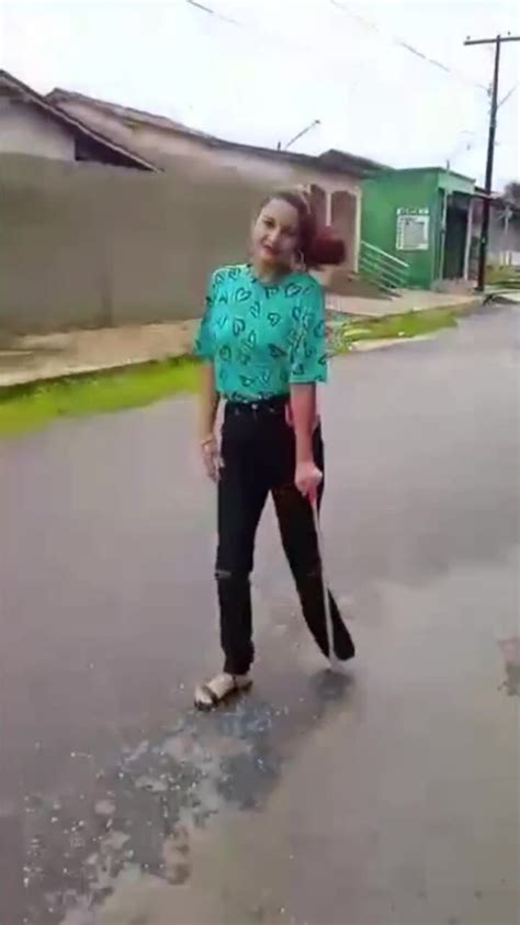 Amputee Girl In One Crutch
