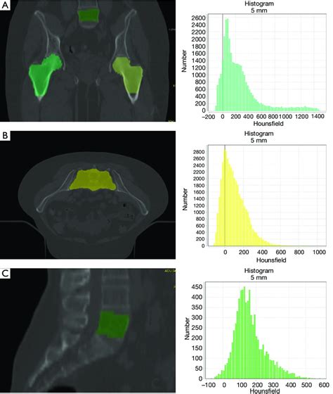 Examples Of Roi And Histograms Of The Pixel Distribution Ct Simulation