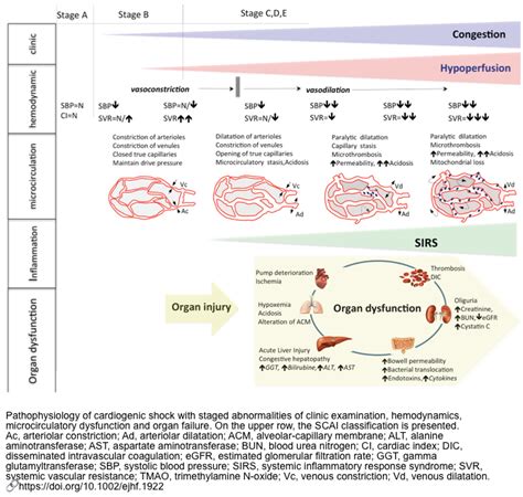 Cardiogenic Shock Recapem