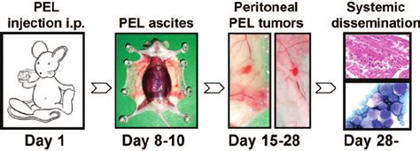 Schematic Representation Of A Pel Mouse Model Immunodeficient Nodscid