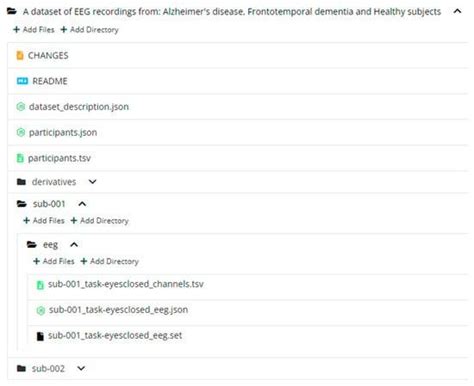 a dataset of scalp eeg recordings of alzheimer s disease