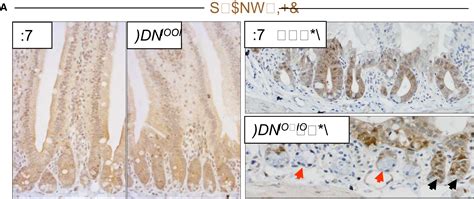 Focal Adhesion Kinase Is Required For Intestinal Regeneration And Tumorigenesis Downstream Of