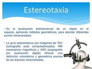 Biopsia Guiada Por Estereotaxia Pptx