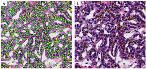 Example Of Calculation Of Evaluation Metrics For Object Detection A Download Scientific