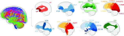 Sagittal View Of Investigated White Matter Fibre Tracts Tracts Download Scientific Diagram