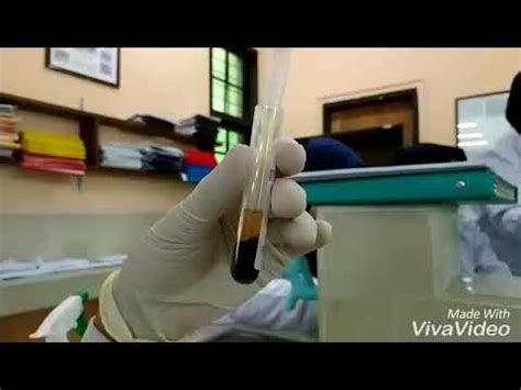 Pencucian Eritrosit Dan Pembuatan Suspensi Untuk Pemeriksaan Golongan Darah ABO Dan Rhesus YouTube