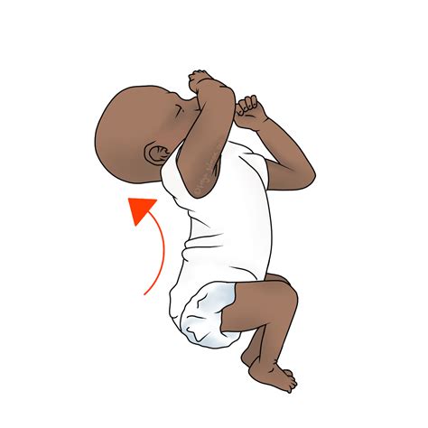 Reflux And Silent Reflux In Babies — Naas Osteopaths Kildare