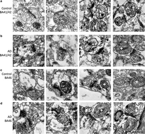 Examples Of Synapses And Synaptic Mitochondria Mitochondria Were Download Scientific Diagram