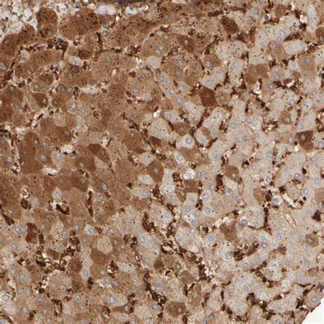 Mst1 Antibodies The Human Protein Atlas