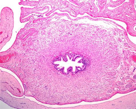 Ductus Deferens Histology Labeled