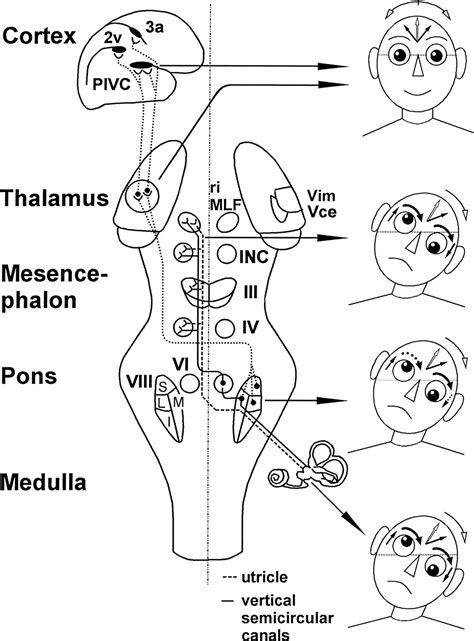 Vestibular Nerve Pathway