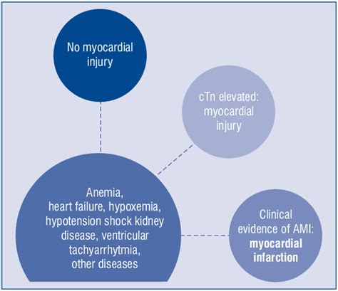 Spectrum Of Myocardial Injury From No Injury To Myocardial Infarction Download Scientific