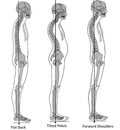 Correct Posture While Standing