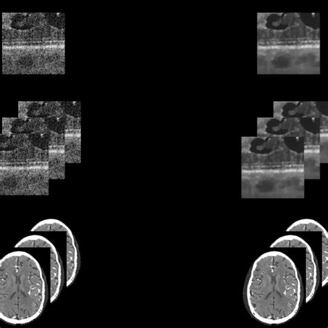 method overview the proposed spatio temporal denoising algorithm is