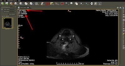 Modify Dicom File Metadata Using Dcm Che In Java Learntocode