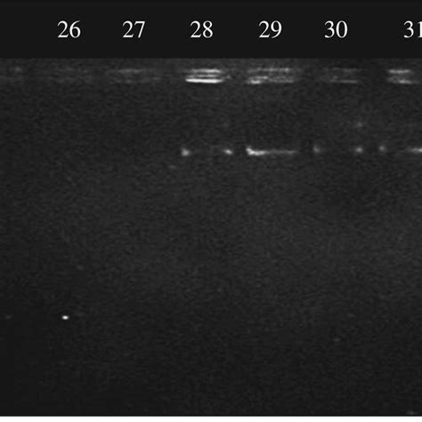 Gel Picture Of Genomic Dna Elution With Elution Buffer 4 Heated Up To Download Scientific