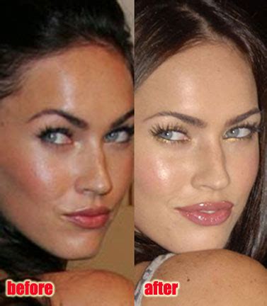 Celebritybuzz Us Megan Fox Botox Lips Injection Before And After