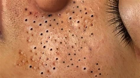 Enjoy Your Day With Hien Nguyen Spa 1733 Youtube