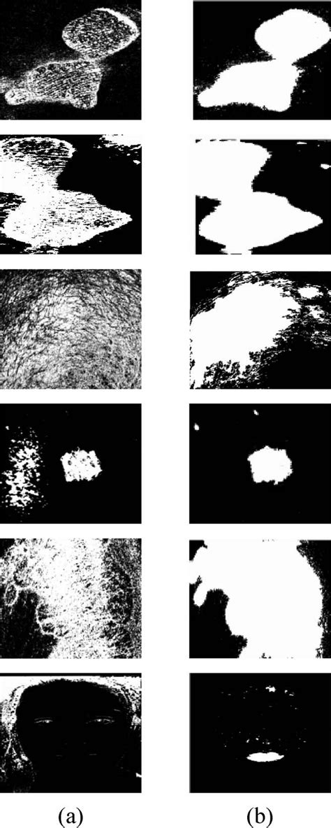 Plaque Segmentation Results Derived From A Our Implementation Of Download Scientific Diagram