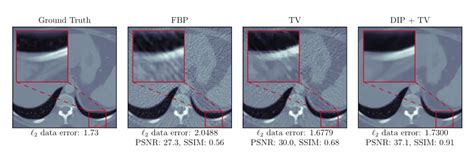 C Reconstruction Obtained With The Filtered Back Projection Fbp Download Scientific Diagram