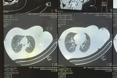 Magnetic Computer Tomography Stock Image Image Of Machine Computed 320024909