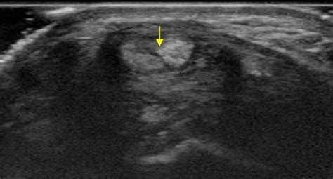 Musculoskeletal Joints And Tendons 63 Wrist And Carpus Case 634