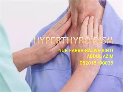 Hyperthyroidism Pptx