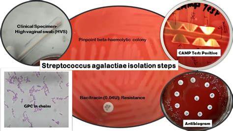 Streptococcus Agalactiae Identification Steps Gram Stain Bacitracin Susceptibility Camp