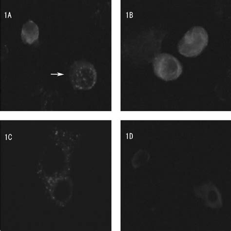 Typical Ifa Staining Of Hmpv Infected Llc Mk2 Cells A Granular