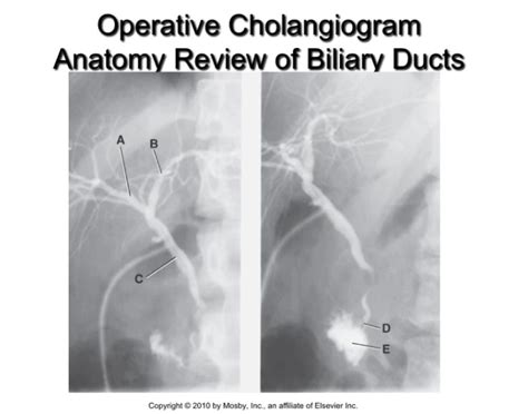 Operative Cholangiogram Anatomy Quiz
