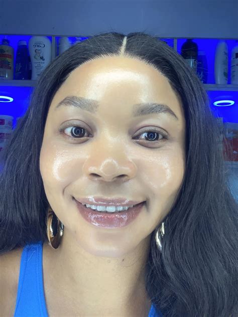 Chioma Sophia What Is Hydroquinone Hydroquinone Is A Skin Lightening