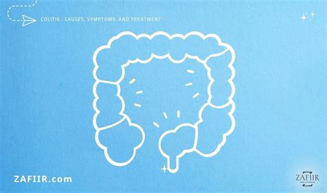 Colitis Causes Symptoms And Treatment