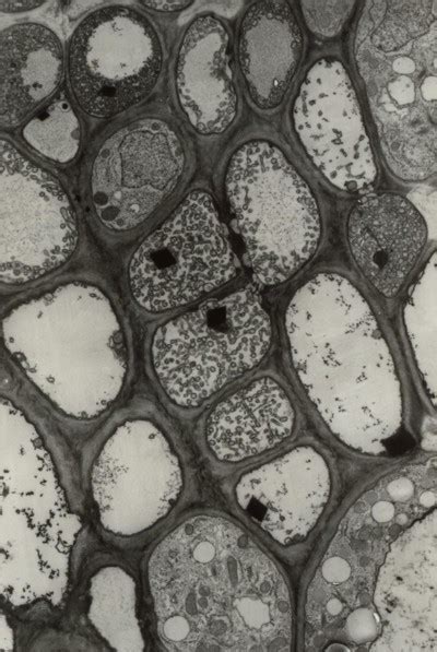 Phytoplasma Cost Fa0807 Working Group 1 Photo Gallery