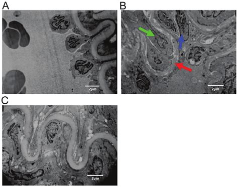 Transmission Electron Microscopy Of The Rat Femoral Artery