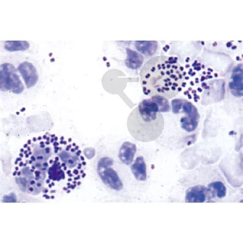 Série Bactéries Pathogènes Svt Conatex