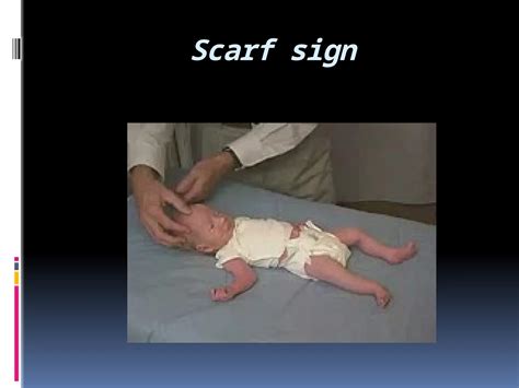 Neonatal Gestational Age Calcualtions Pic Pptx