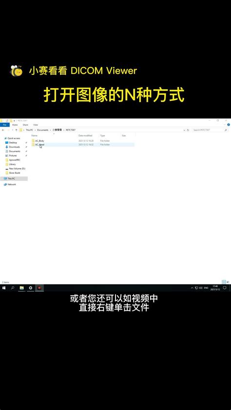 带你认识dicom 知乎